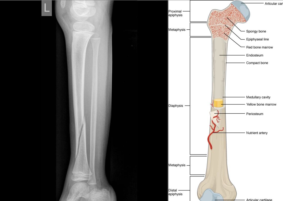 Нов хидрогел помага за растежа на костите без трансплантация или ...