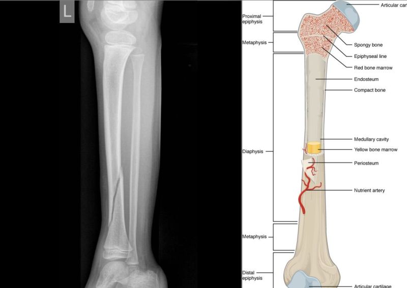 Нов хидрогел помага за растежа на костите без трансплантация или ...